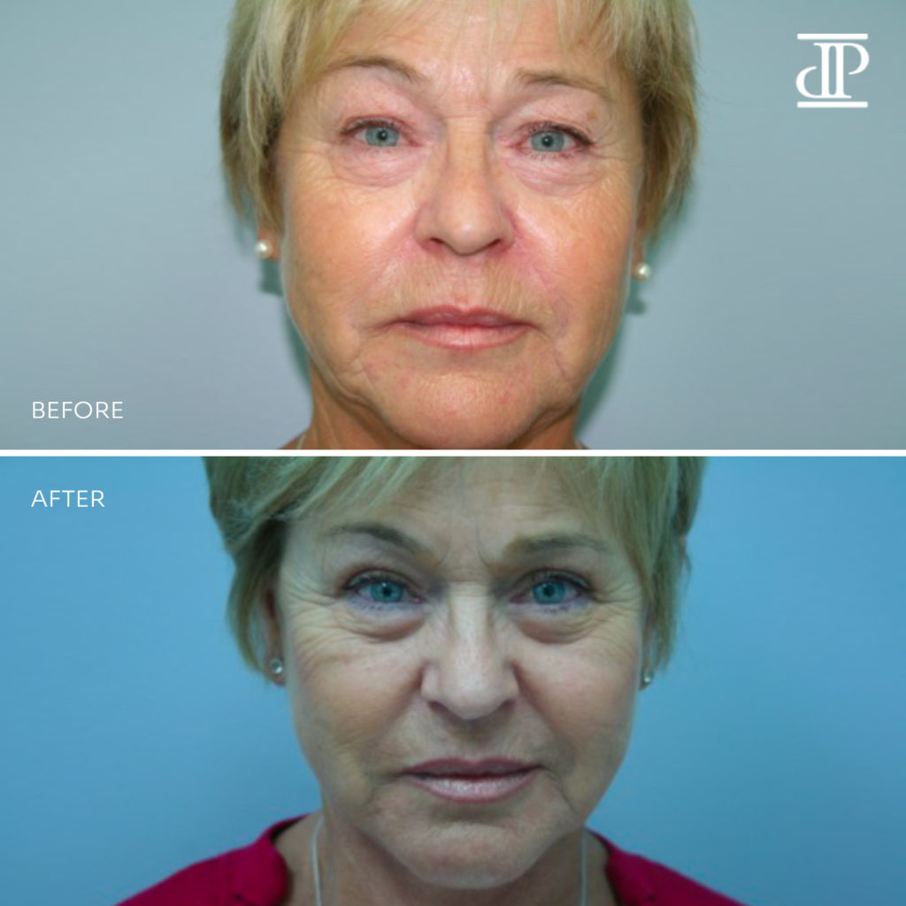 Gallery - The Westmount Institute of Plastic Surgery in Montreal